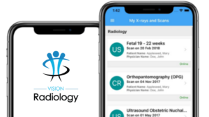 Vision Radiology - Areas we service